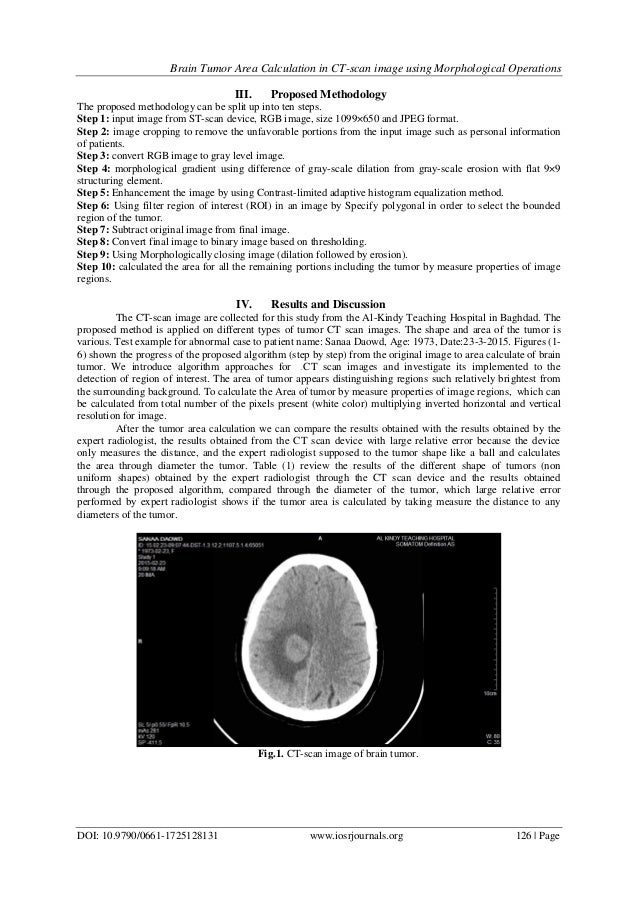 Brain Tumor Area Calculation In Ct Scan Image Using Morphological Ope…