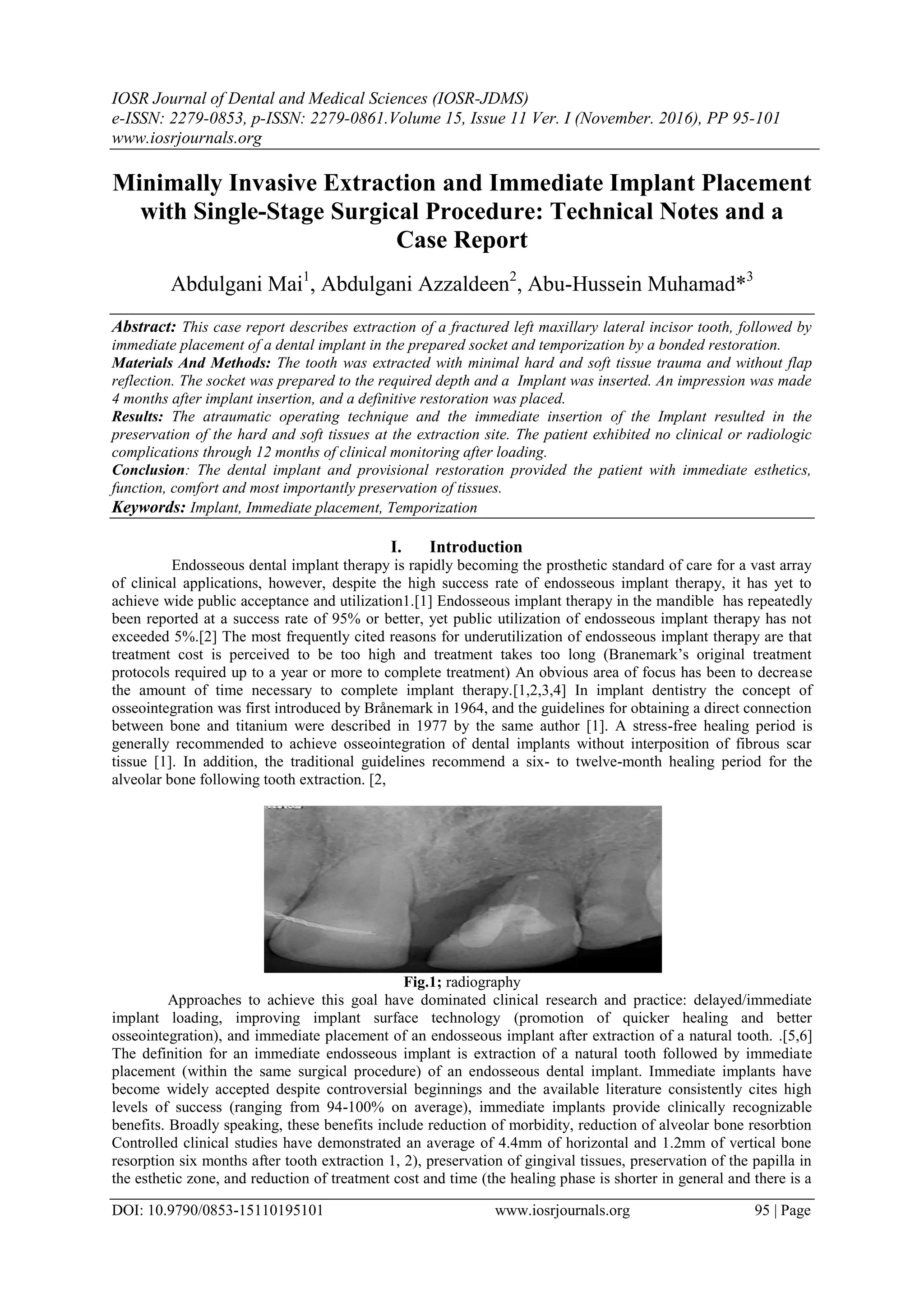 Minimally Invasive Extraction and Immediate Implant Placement with Single-Stage Surgical ...