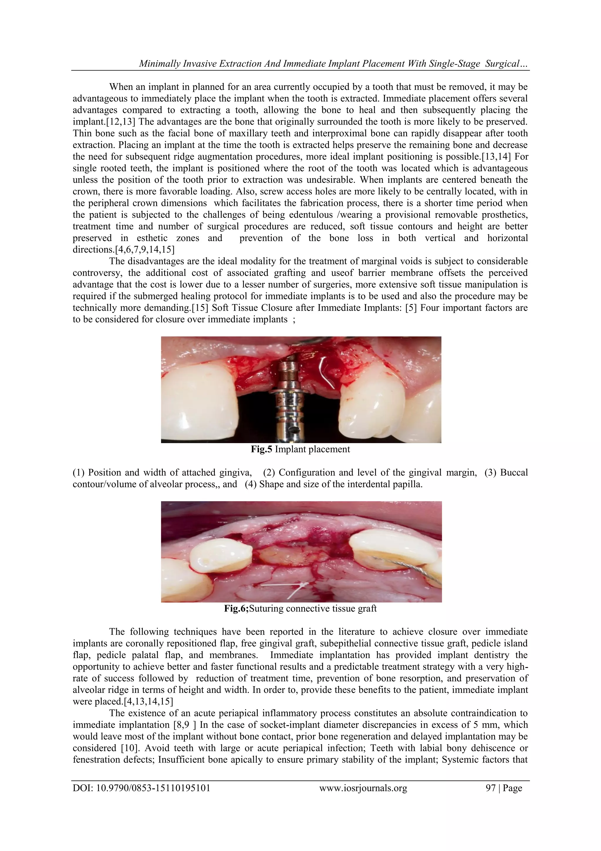 Minimally Invasive Extraction and Immediate Implant Placement with Single-Stage Surgical ...