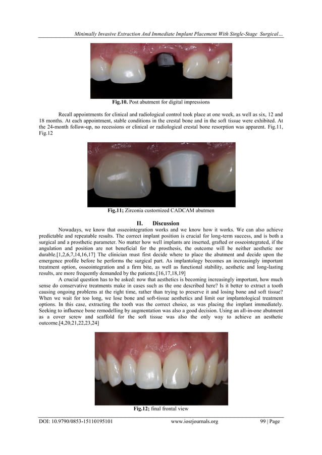 Minimally Invasive Extraction and Immediate Implant Placement with Single-Stage Surgical ...