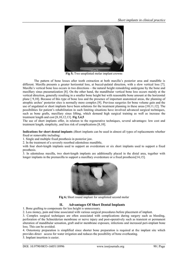 Short implants in clinical practice | PDF