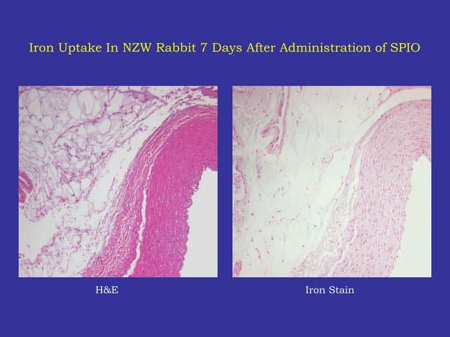 050 periadventitial fat | PPT