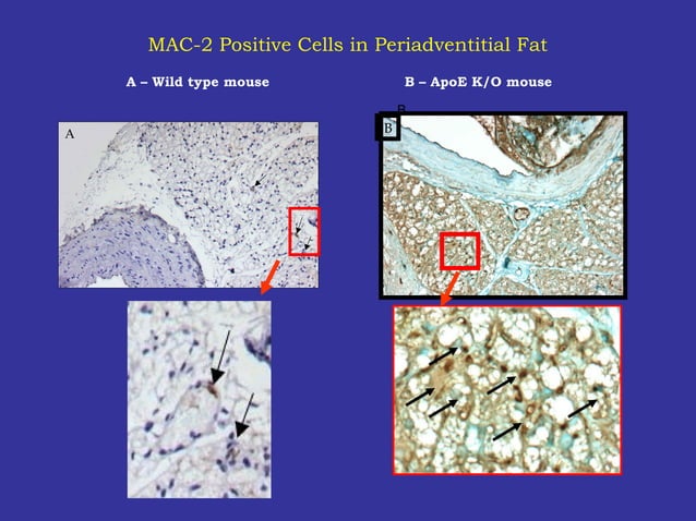 050 periadventitial fat | PPT