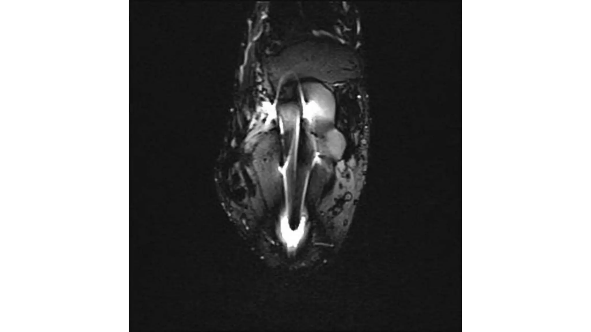 T1 T2 Fat saturation MRI.pptx
