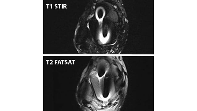 T1 T2 Fat saturation MRI.pptx