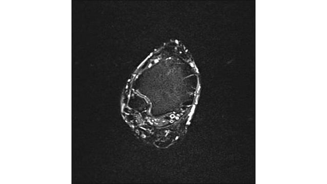 T1 T2 Fat saturation MRI.pptx