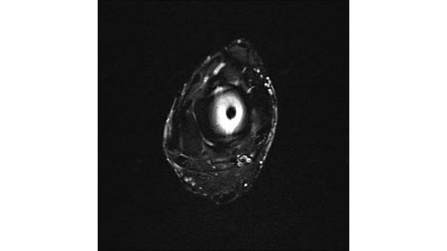 T1 T2 Fat saturation MRI.pptx