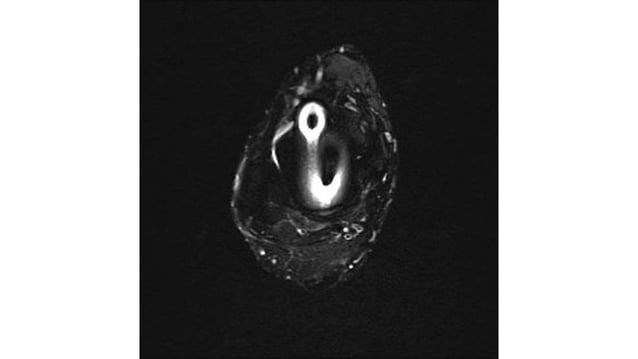 T1 T2 Fat saturation MRI.pptx