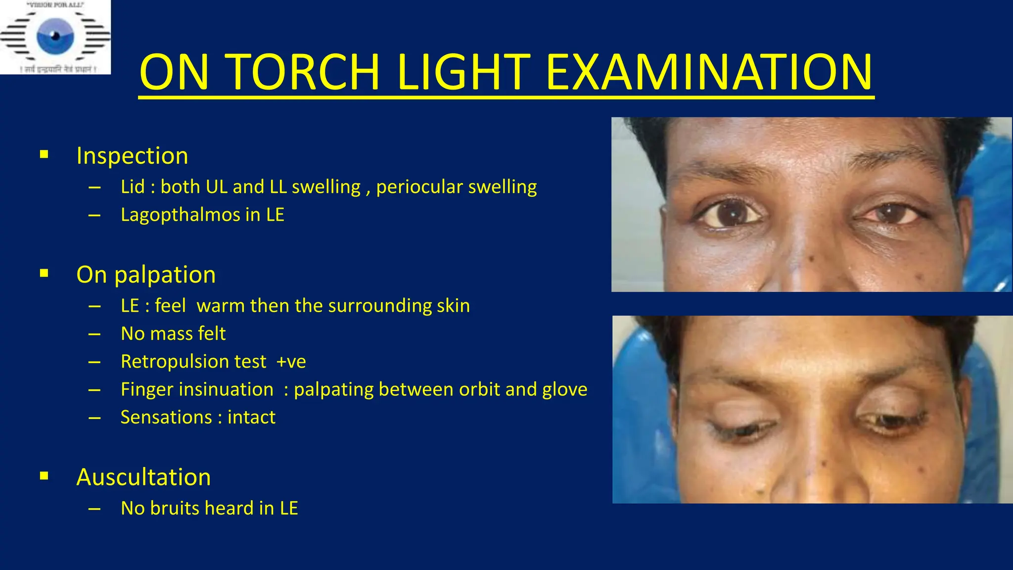 orbital_pseudotumor presentation dhir hospital bhiwani.pptx