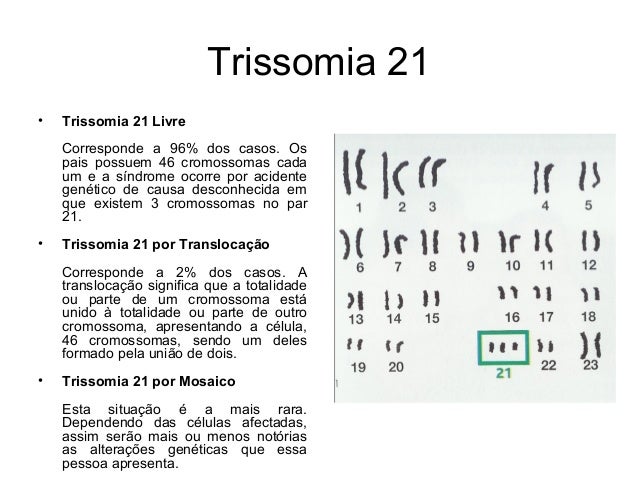Workshop Trissomia 21