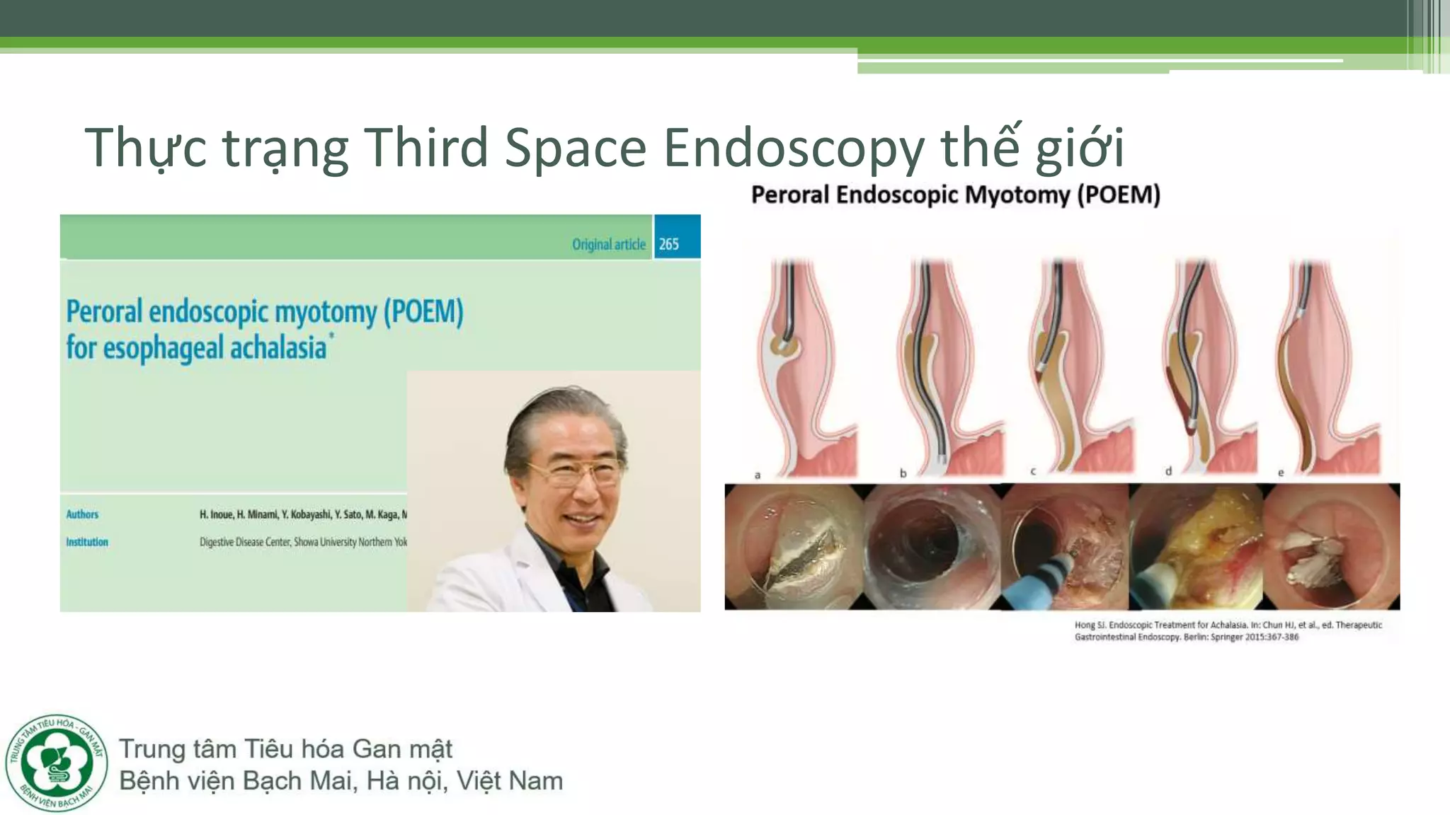 Dr_Duong__Third_Space_Endoscopy.pptx
