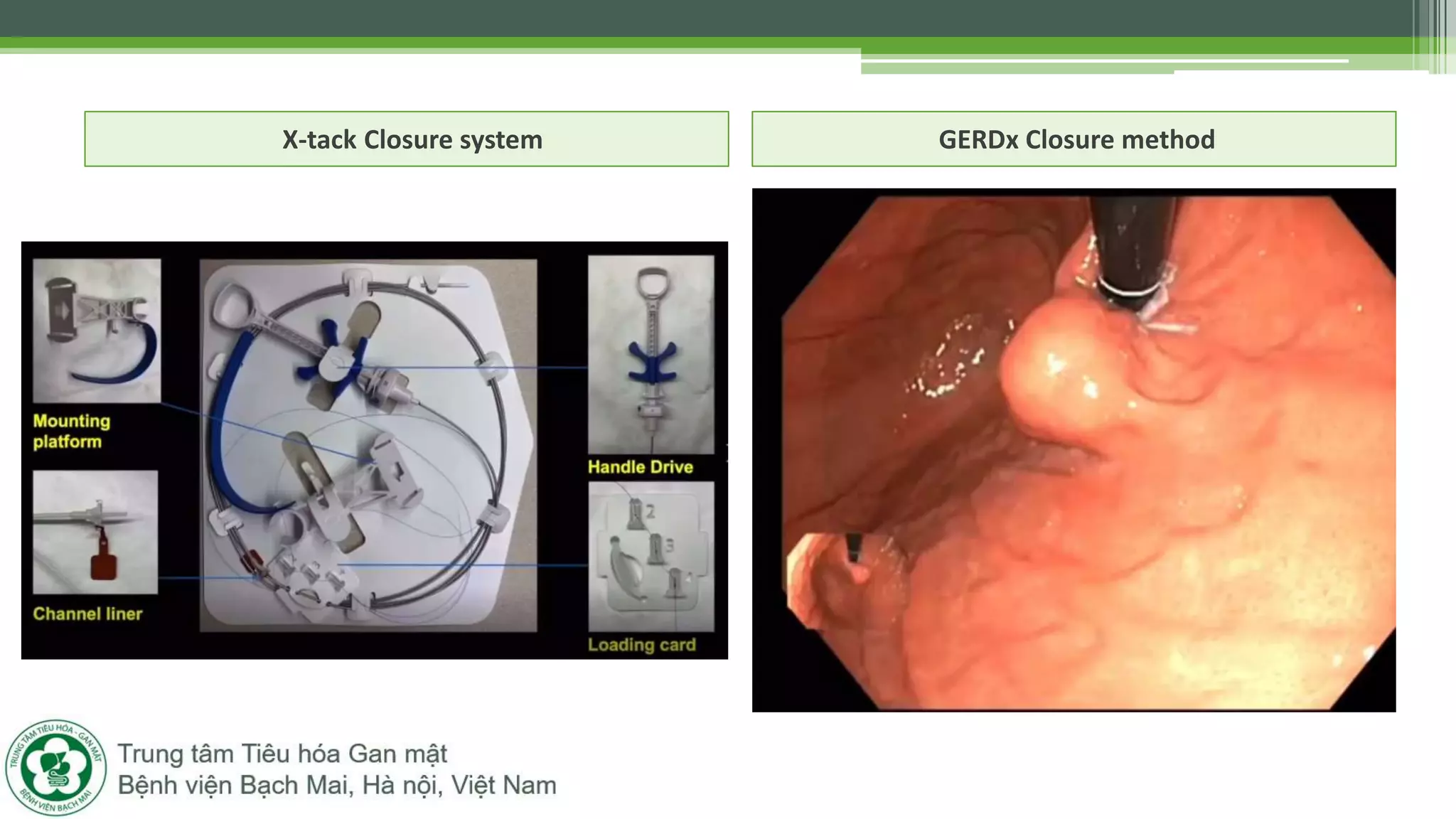 Dr_Duong__Third_Space_Endoscopy.pptx