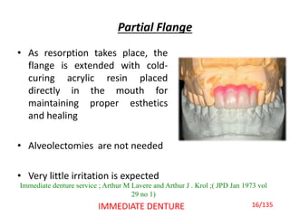 Immediate Partial Dentures