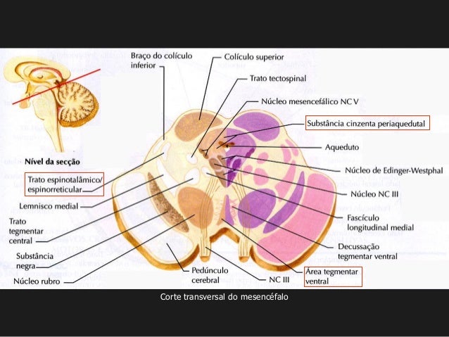 T4 formacao reticular