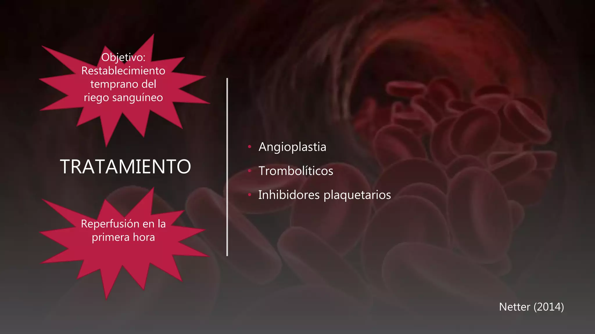 Infarto agudo al miocardio | PPTX