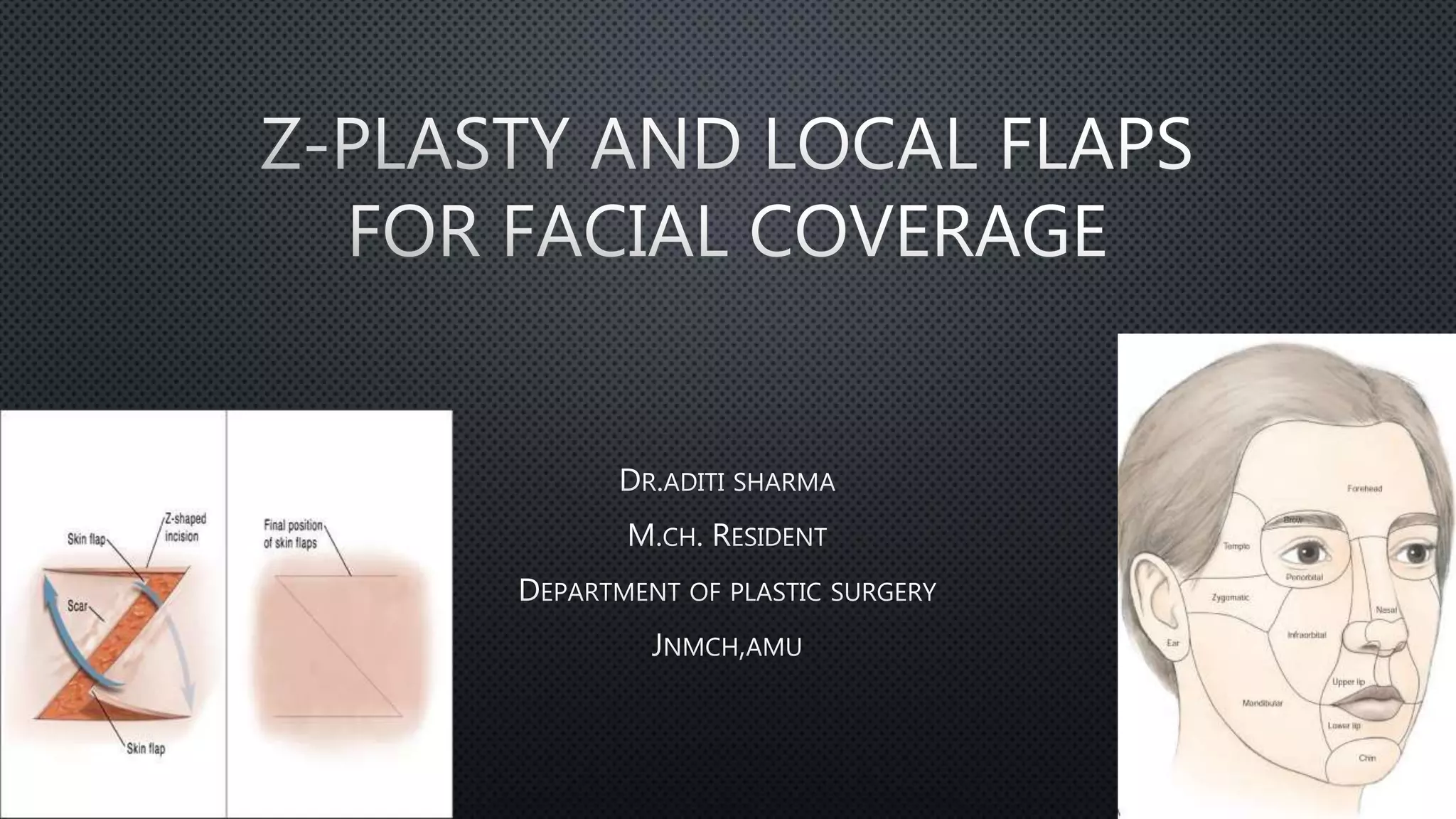 Facial flaps | PPTX