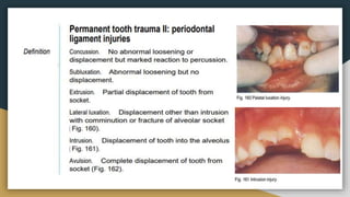 Permenant tooth trauma | PPTX