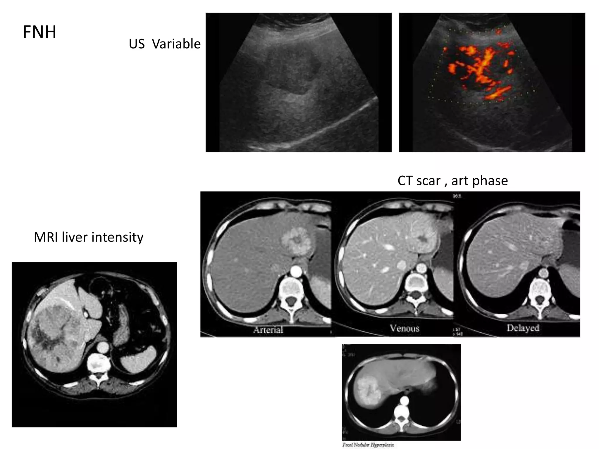 Focal hepatic lesions in concerns of diagnostic imaging .pptx 1 | PPTX