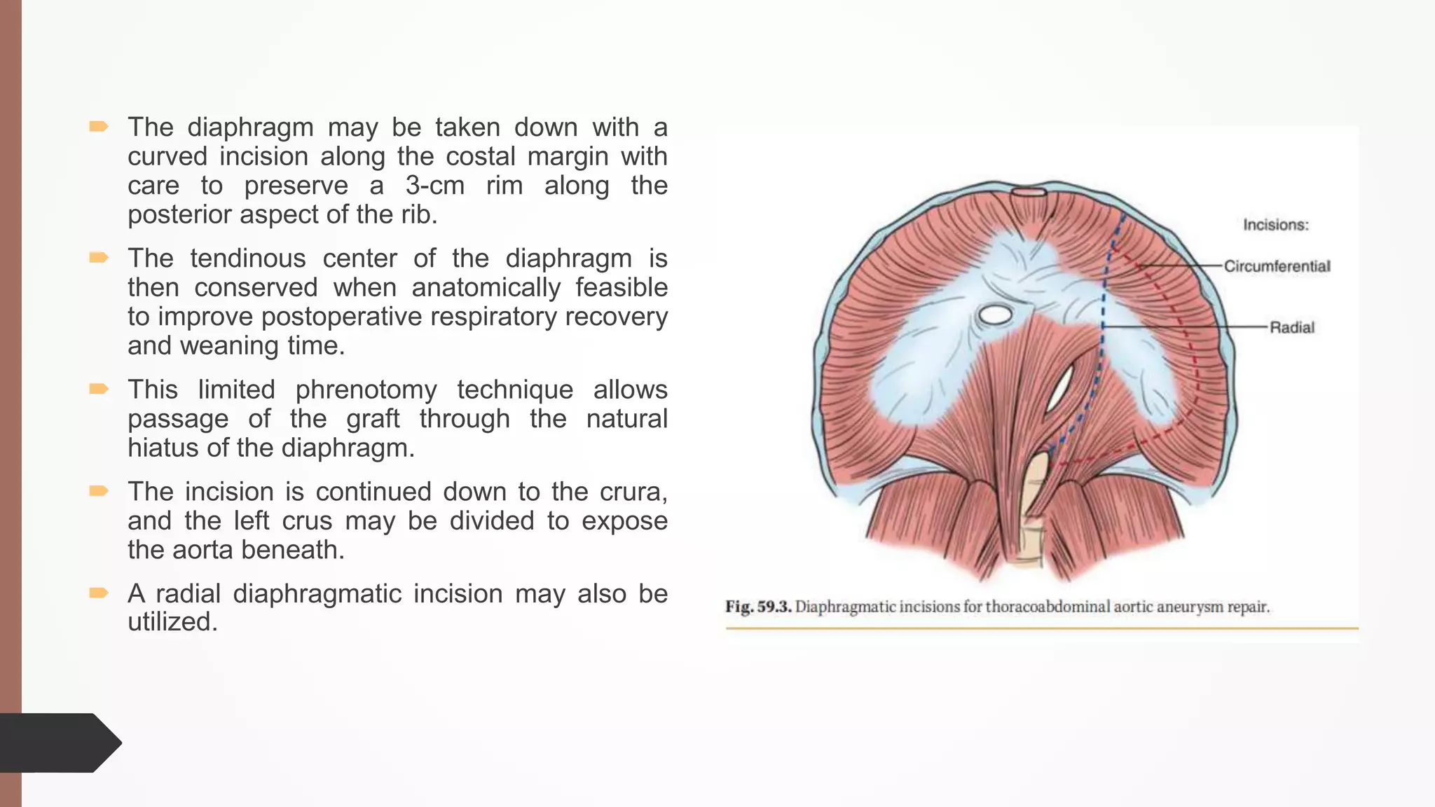 Thoraco abdominal aortic aneurysm(TAAA) management | PPTX