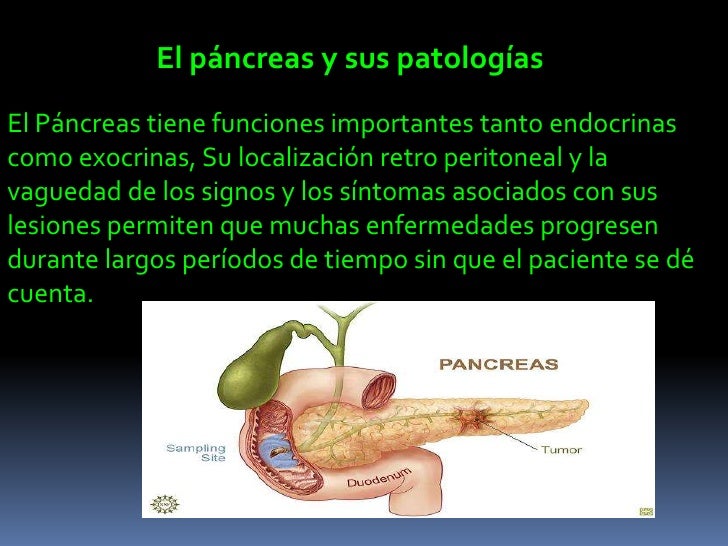Problemas En El Pancreas Sintomas