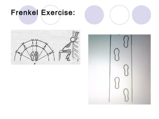 Tabes Dorsalis and Physiotherapy | PPT