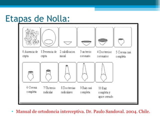Tabla de-nolla-2b | PPT