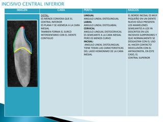 TABLAS_DE_ANATOMIA_DENTAL_2DA_DENTICION.pdf