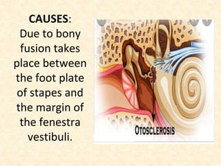 CLINICAL ASPECTS related to Ear anatomy.pptx