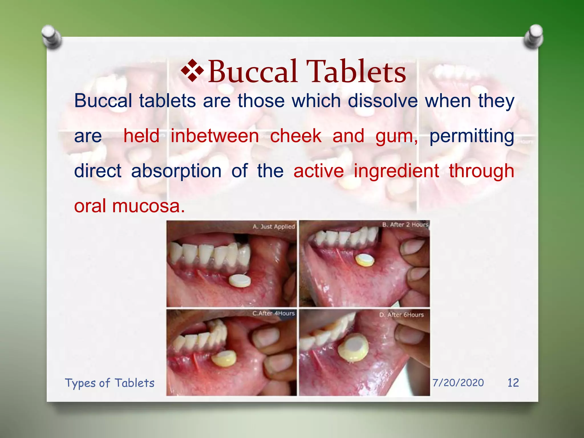 Tablets (Types of tablets) | PPTX
