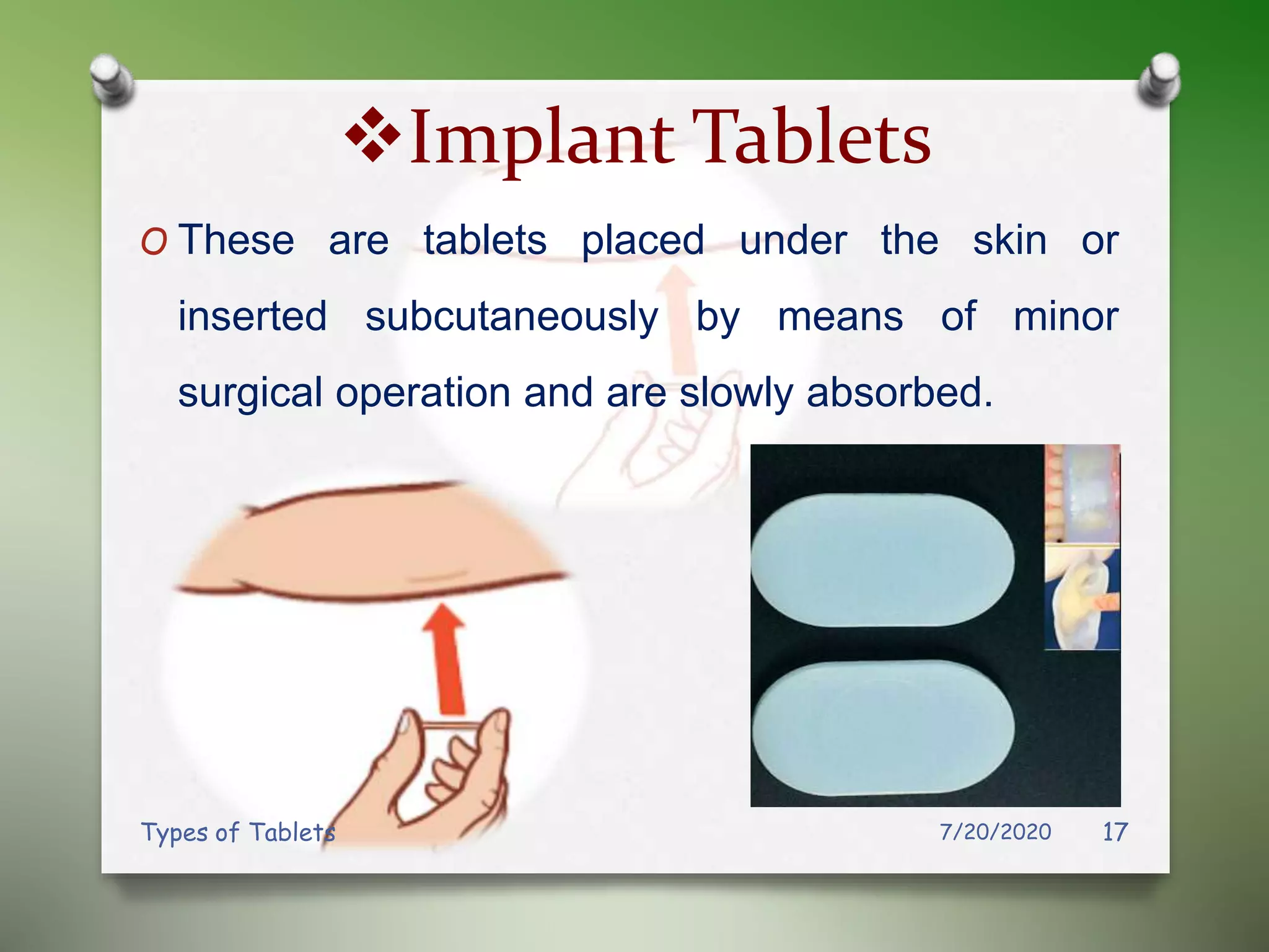 Tablets (Types of tablets) | PPTX