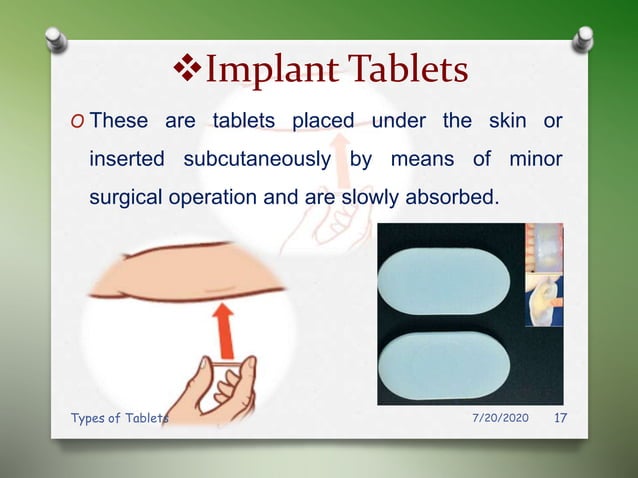 Tablets (Types of tablets) | PPTX
