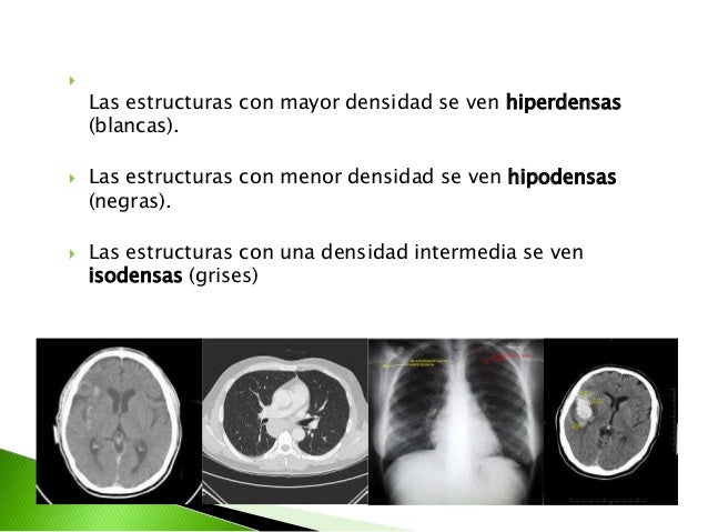 TAC y Medios de Contraste