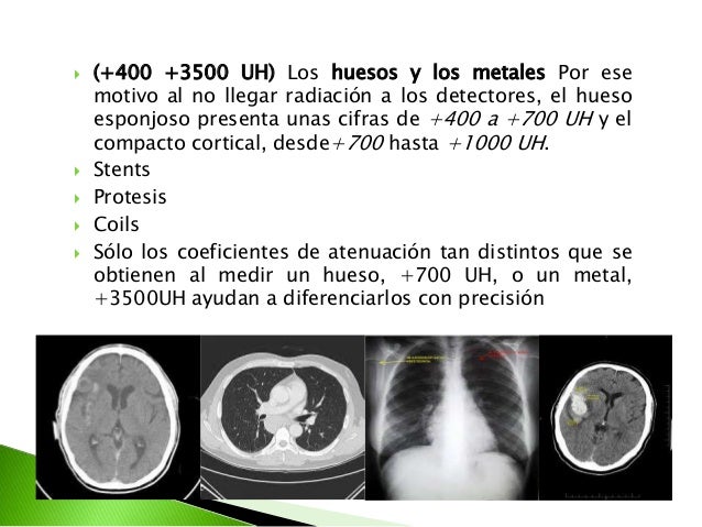 TAC y Medios de Contraste