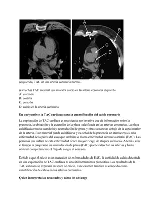 Tomografia del aparato cardiovascular | DOCX