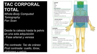 Tac corporal total en trauma | PPTX