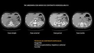 TAC DE ABDOMEN.pdf