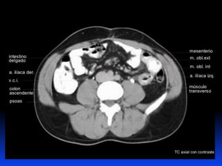 TAC de Abdomen y pelvis.pdf