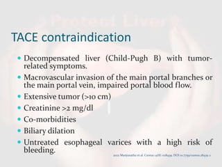 TACE- As a management option of HCC.pptx