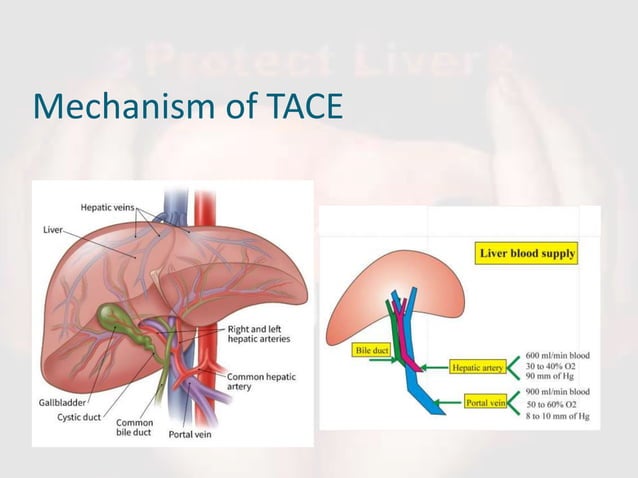 TACE- As a management option of HCC.pptx | Blood Disorders | Diseases ...