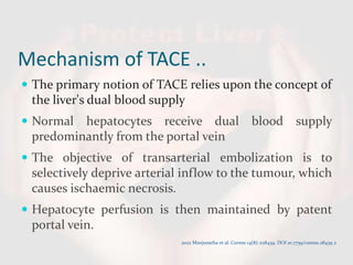TACE- As a management option of HCC.pptx