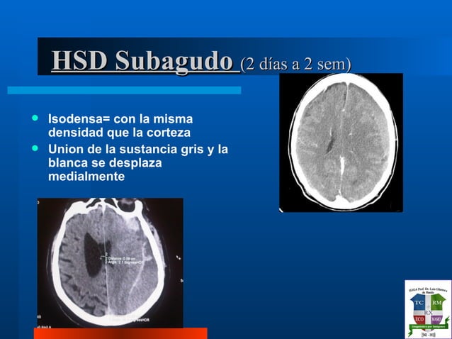 Tac en trauma de encefalo | PPT
