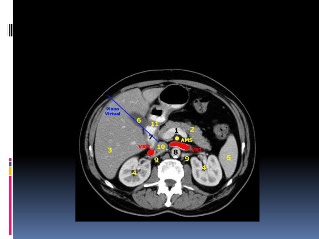 Tac higado pancreas y vesicula biliar