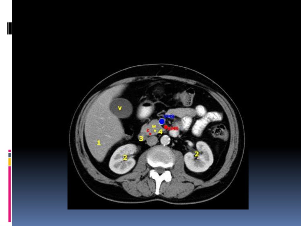 Tac higado pancreas y vesicula biliar