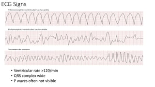 tachy.pptx | Free download