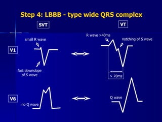 Tachyarrhythmia | PPT