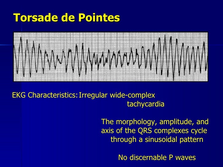 Tachyarrhythmia