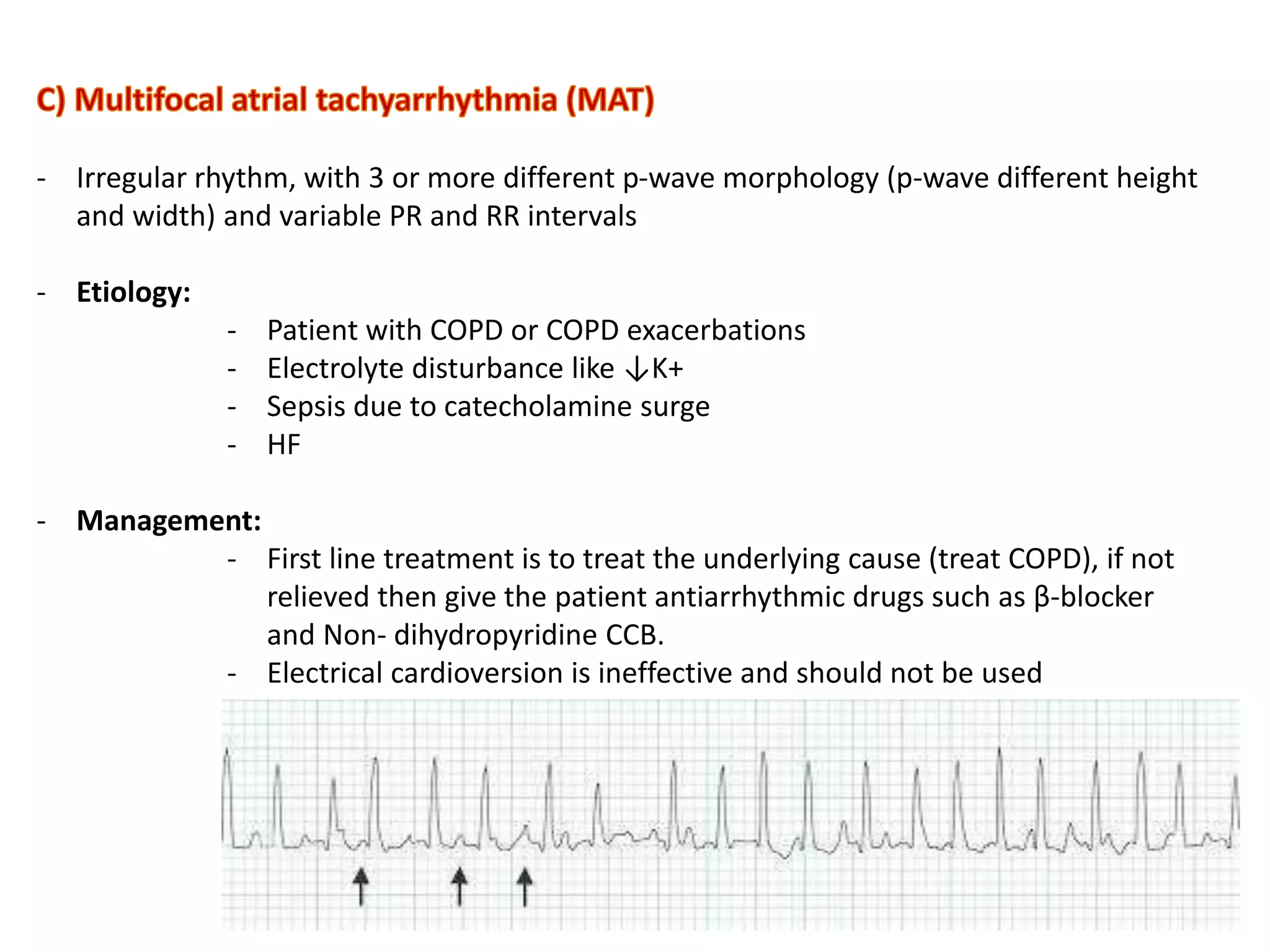 Tachyarrhythmia l.pptx