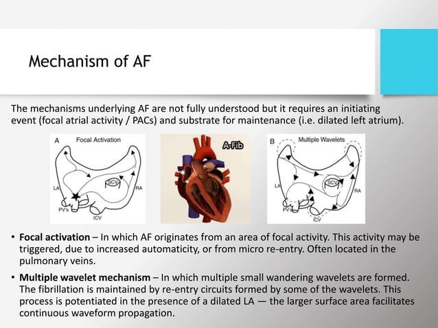 Tachy Arrhythmias - Approach to Management | PPTX