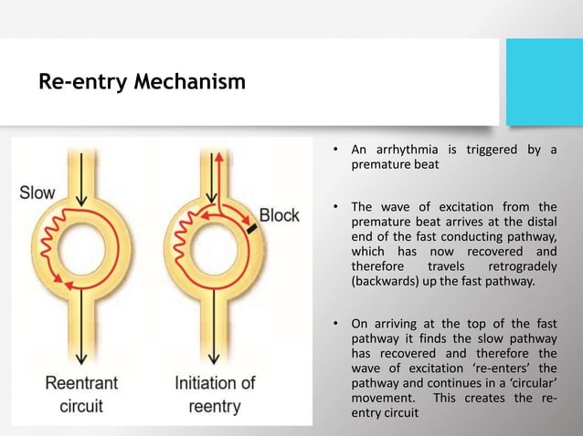 Tachy Arrhythmias - Approach to Management | PPTX