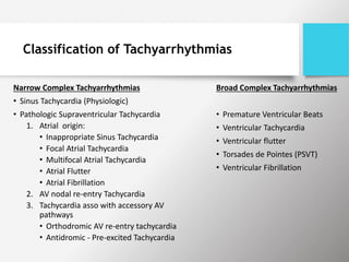Tachy Arrhythmias - Approach to Management